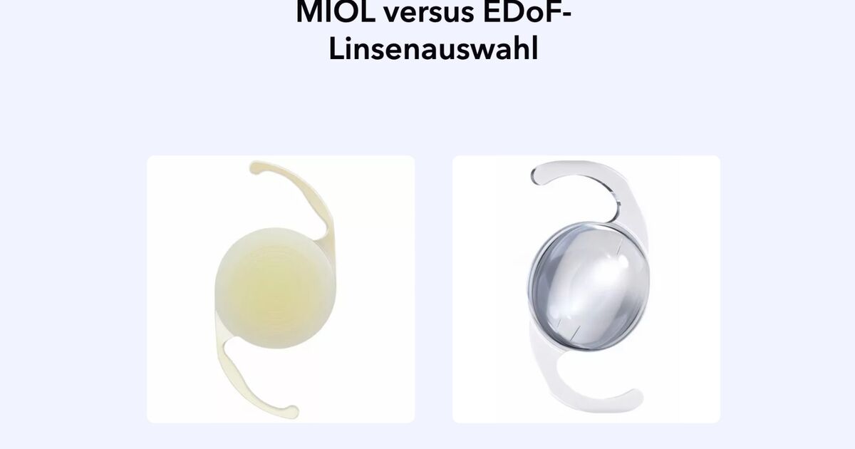 MIOL versus EDoF-IOL Auswahl